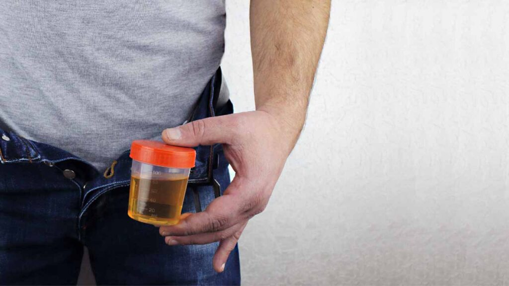El color de la orina y su relación con la salud urinaria: qué significa ...