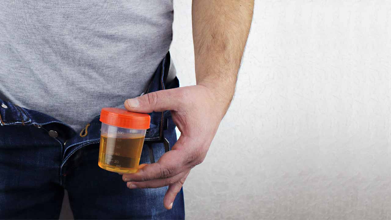 El color de la orina y su relación con la salud urinaria: qué significa ...